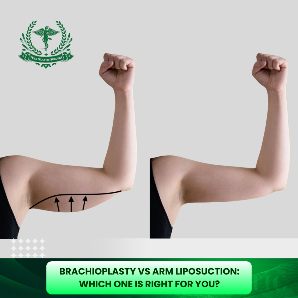 Brachioplasty (Arm Lift): Surgery, Recovery, Cost and Cautions